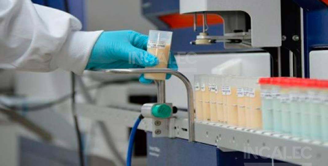 Análisis de Leche | Propiedades y Calidad